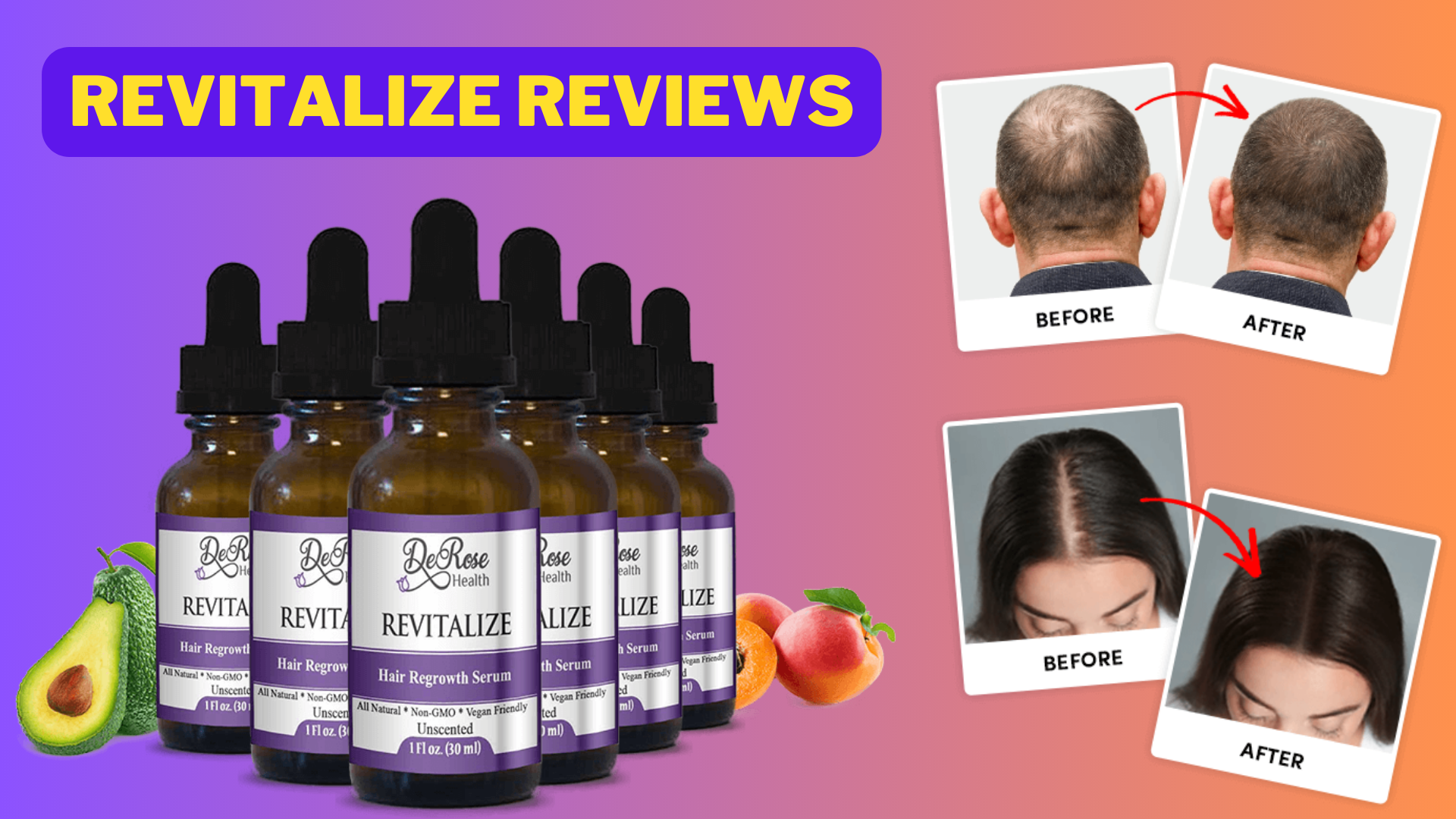 Revitalize Reviews 2024-Does It Minimize Hair Breakages?
